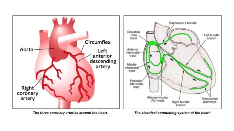 Sudden Cardiac Death: What you SHOULD know ? - Star of Mysore